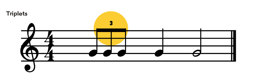 How to Read Music: A Step by Step Guide to Reading Music | LANDR Blog